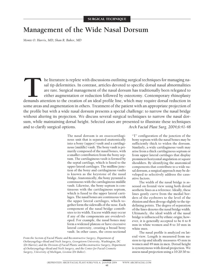 Management of the wide nasal dorsum