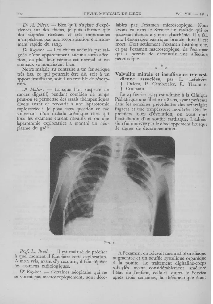 Mitral valvulitis and associated tricuspid insufficiency