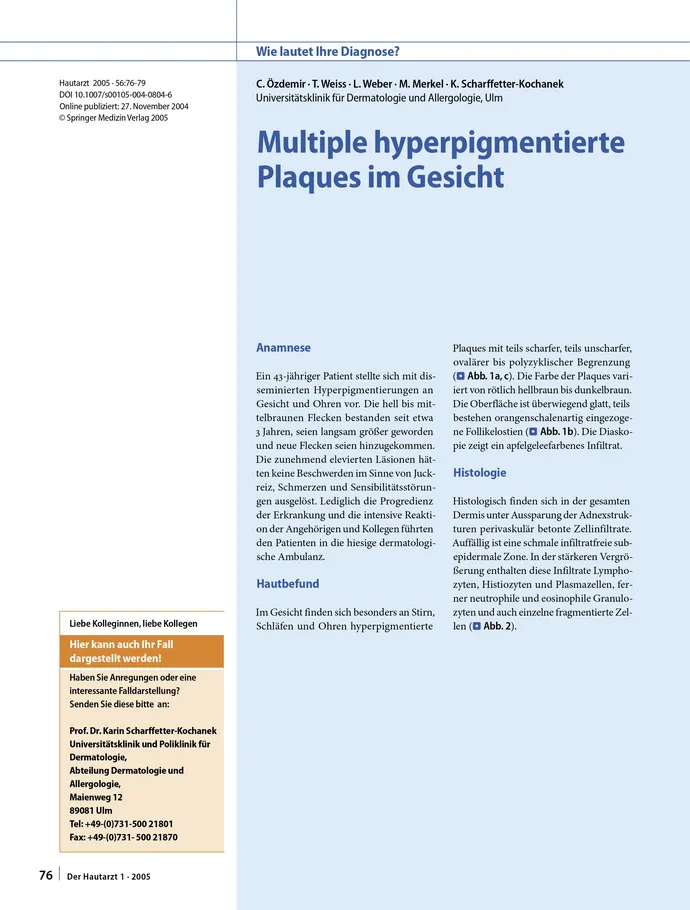 Multiple hyperpigmented facial plaques