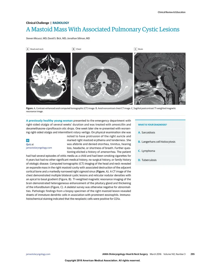 A Mastoid Mass with Associated Pulmonary Cystic Lesions